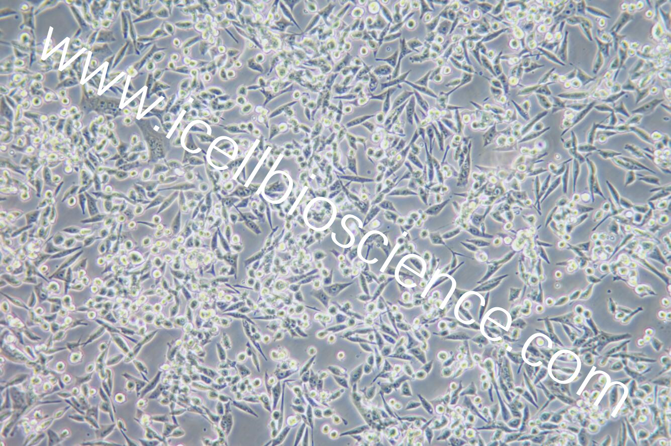 E0771 小鼠髓样乳腺癌细胞-原代细胞-STR细胞-细胞培养基-镜像绮点生物