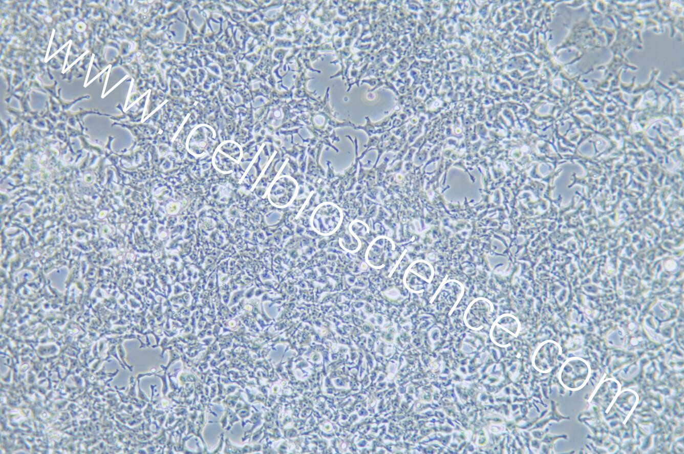AAV-293 人胚肾细胞-原代细胞-STR细胞-细胞培养基-镜像绮点生物