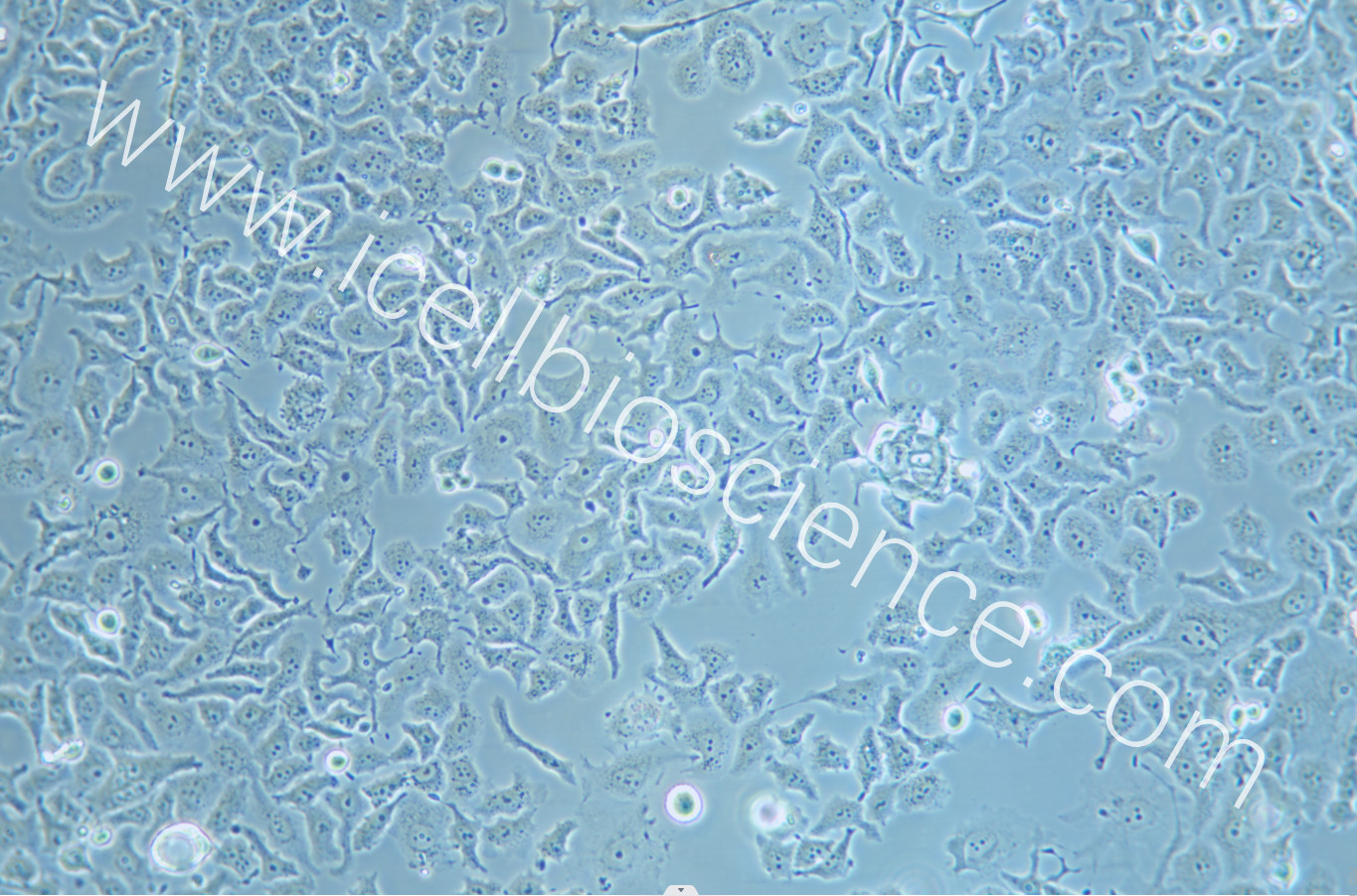DMS 114 人小细胞肺癌细胞-原代细胞-STR细胞-细胞培养基-镜像绮点生物