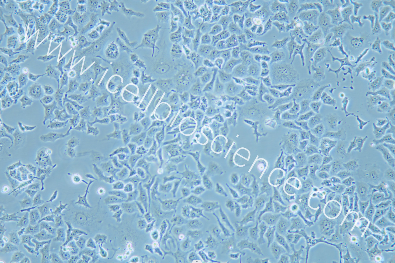 DMS 114 人小细胞肺癌细胞-原代细胞-STR细胞-细胞培养基-镜像绮点生物