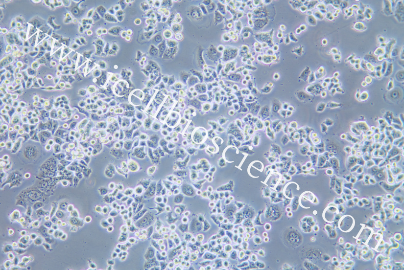 AU565 人乳腺癌细胞-原代细胞-STR细胞-细胞培养基-镜像绮点生物