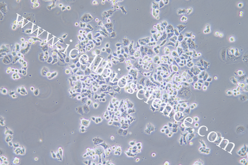 AU565 人乳腺癌细胞-原代细胞-STR细胞-细胞培养基-镜像绮点生物