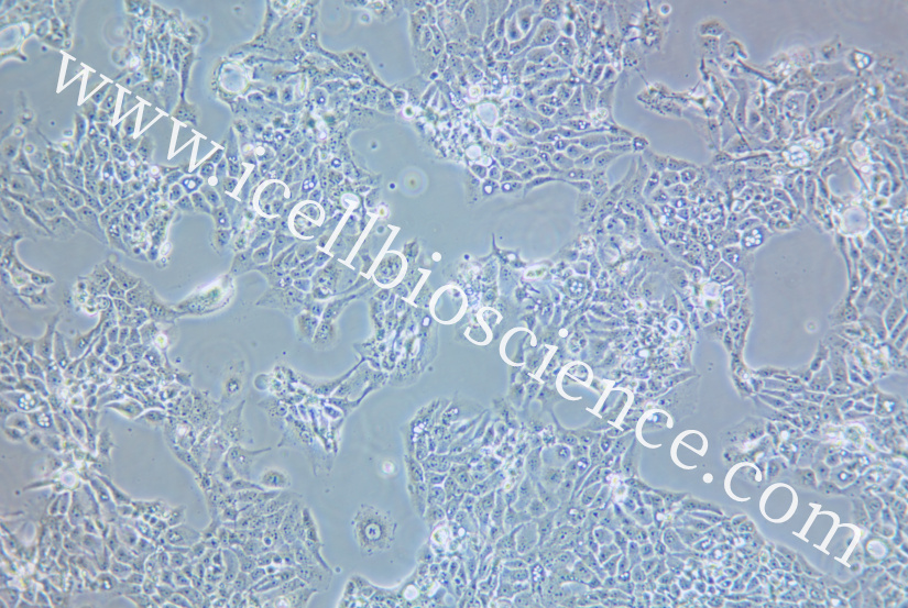 CAL33 人舌磷癌细胞-原代细胞-STR细胞-细胞培养基-镜像绮点生物