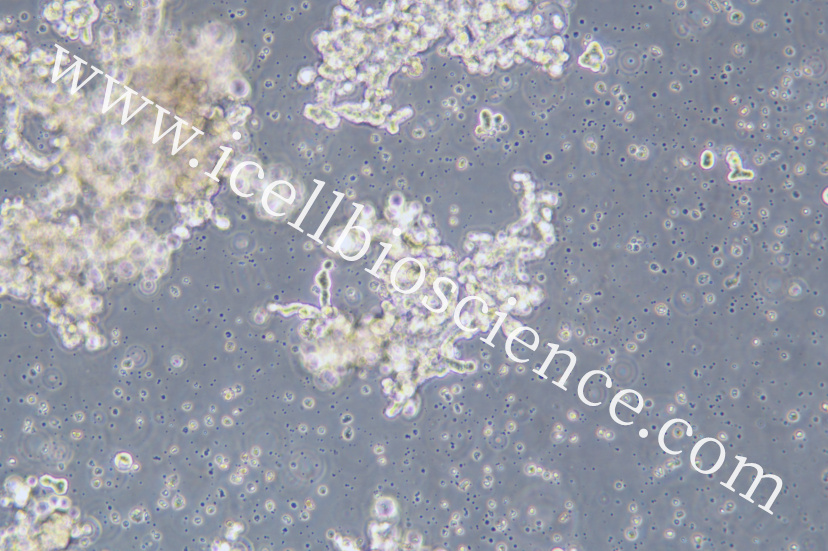DU4475 人乳腺上皮细胞-原代细胞-STR细胞-细胞培养基-镜像绮点生物