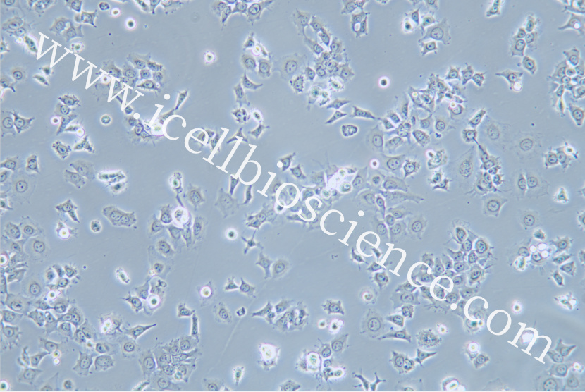 HCC1588 人肺鳞癌细胞-原代细胞-STR细胞-细胞培养基-镜像绮点生物
