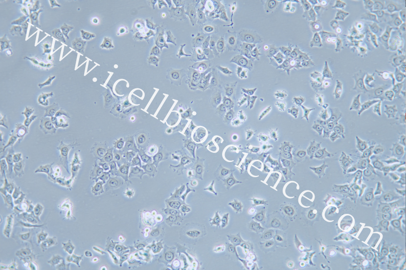 HCC1588 人肺鳞癌细胞-原代细胞-STR细胞-细胞培养基-镜像绮点生物