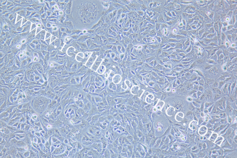 HCC1806 人乳腺鳞状癌细胞-原代细胞-STR细胞-细胞培养基-镜像绮点生物