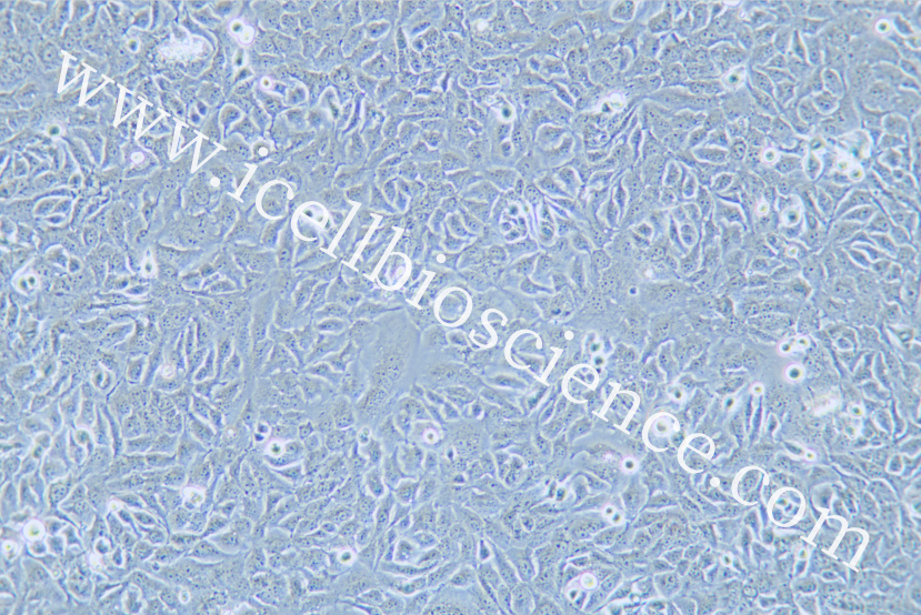HCC1806 人乳腺鳞状癌细胞-原代细胞-STR细胞-细胞培养基-镜像绮点生物