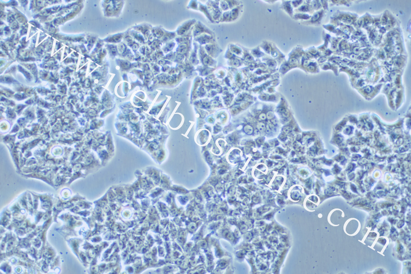 HCC1833 人肺癌腺癌细胞-原代细胞-STR细胞-细胞培养基-镜像绮点生物