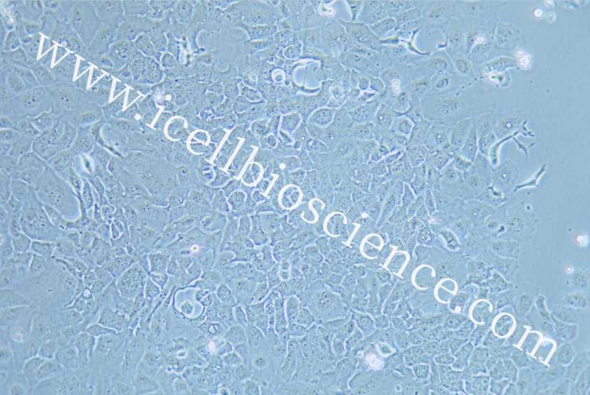 HCC1954 人乳腺导管癌细胞-原代细胞-STR细胞-细胞培养基-镜像绮点生物
