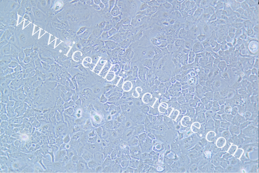 HCC1954 人乳腺导管癌细胞-原代细胞-STR细胞-细胞培养基-镜像绮点生物