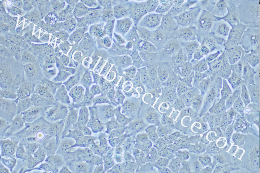 HCC1954 人乳腺导管癌细胞-原代细胞-STR细胞-细胞培养基-镜像绮点生物