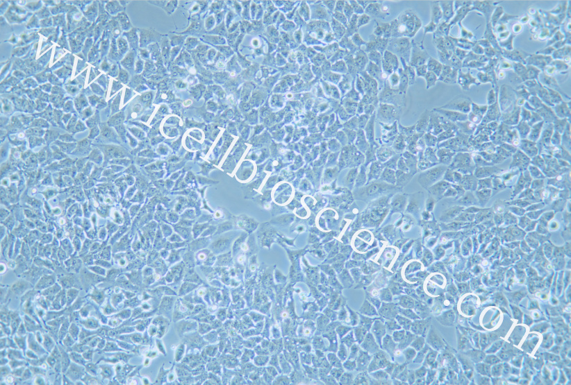 HCC-LM3+luc 高转移人肝癌细胞稳定表达荧光素酶-原代细胞-STR细胞-细胞培养基-镜像绮点生物