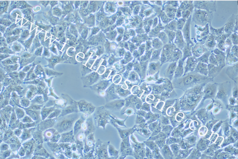 HCC-LM3+luc 高转移人肝癌细胞稳定表达荧光素酶-原代细胞-STR细胞-细胞培养基-镜像绮点生物