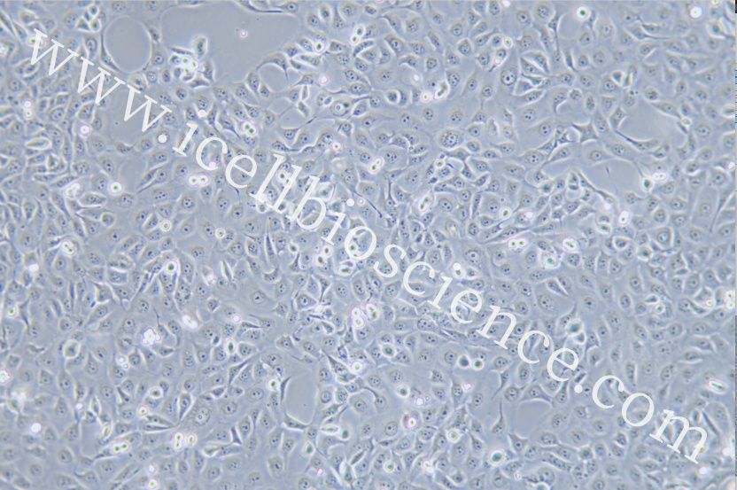 HCE-T 人角膜上皮细胞-原代细胞-STR细胞-细胞培养基-镜像绮点生物