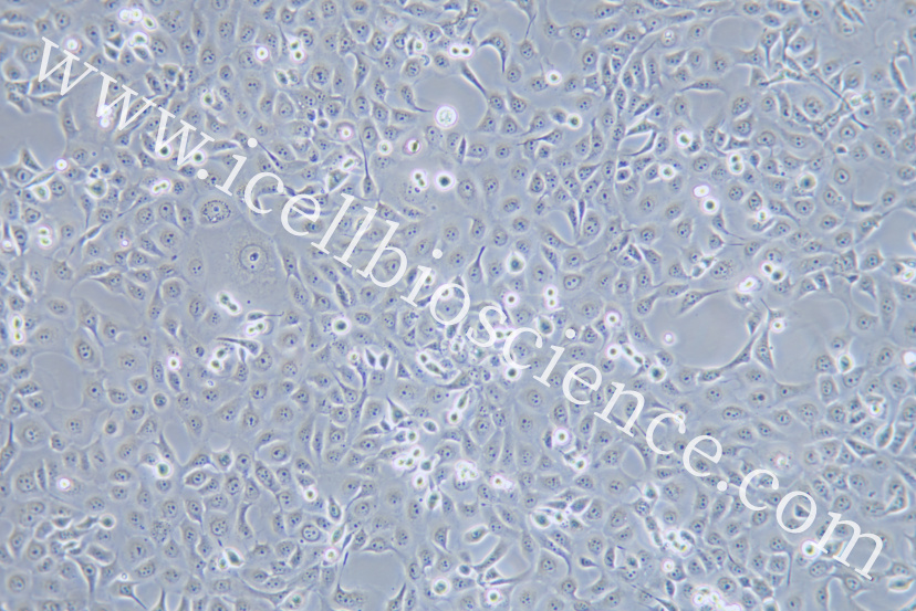 HCE-T 人角膜上皮细胞-原代细胞-STR细胞-细胞培养基-镜像绮点生物