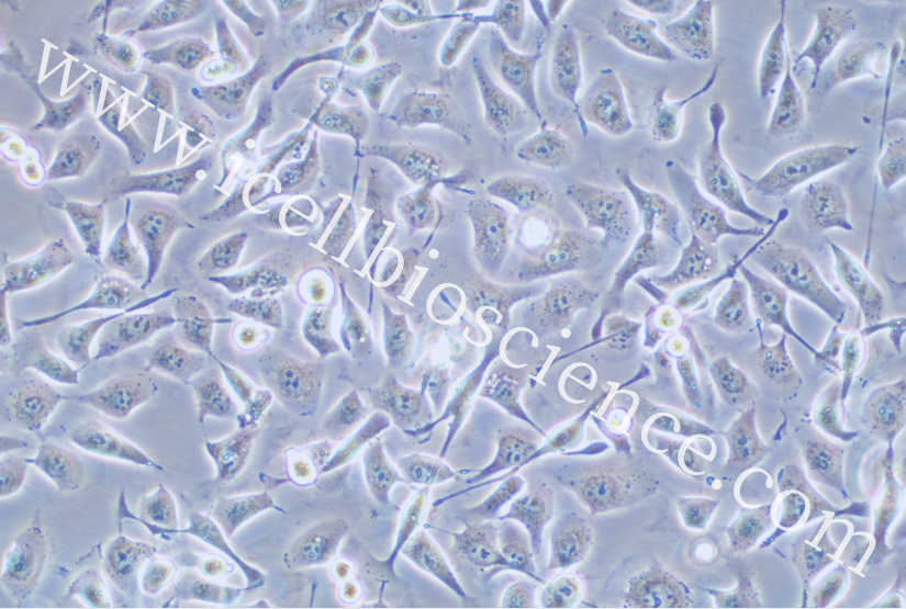 HNE1 人鼻咽癌细胞-原代细胞-STR细胞-细胞培养基-镜像绮点生物