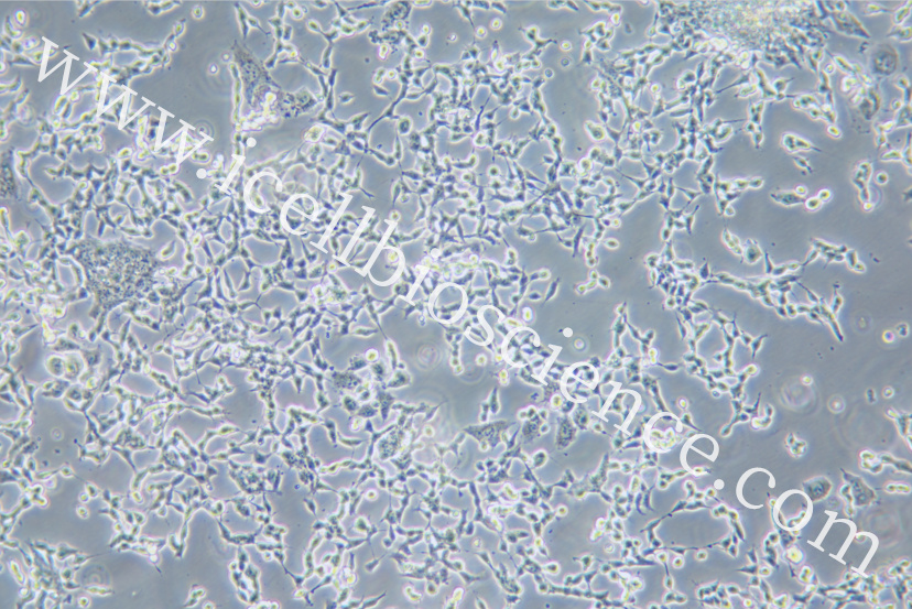 IMR-32 人神经母细胞瘤细胞-原代细胞-STR细胞-细胞培养基-镜像绮点生物