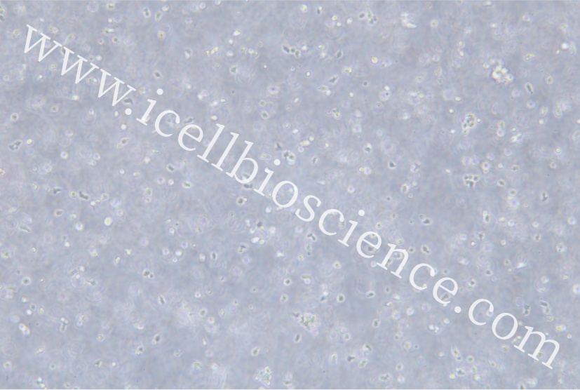 MEC-1 人慢性B细胞白血病细胞-原代细胞-STR细胞-细胞培养基-镜像绮点生物