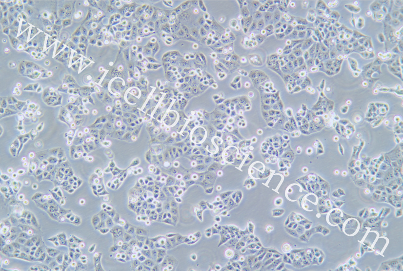MKN-74 人胃癌细胞-原代细胞-STR细胞-细胞培养基-镜像绮点生物