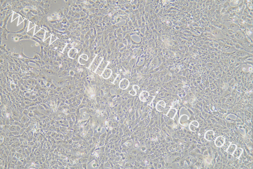 4T1+GFP 小鼠乳腺癌细胞绿色荧光标记-原代细胞-STR细胞-细胞培养基-镜像绮点生物