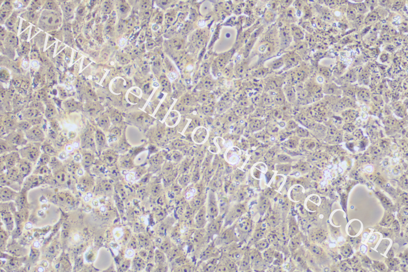 4T1+GFP 小鼠乳腺癌细胞绿色荧光标记-原代细胞-STR细胞-细胞培养基-镜像绮点生物