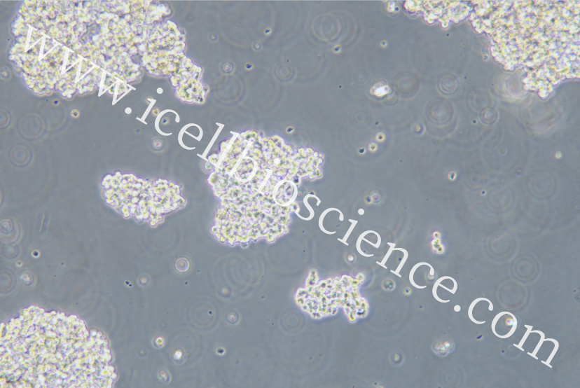 NCI-H69 人小细胞肺癌细胞-原代细胞-STR细胞-细胞培养基-镜像绮点生物