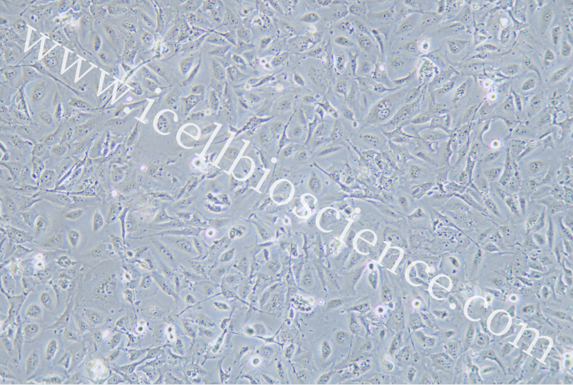 NP69 人永生化鼻咽上皮细胞-原代细胞-STR细胞-细胞培养基-镜像绮点生物