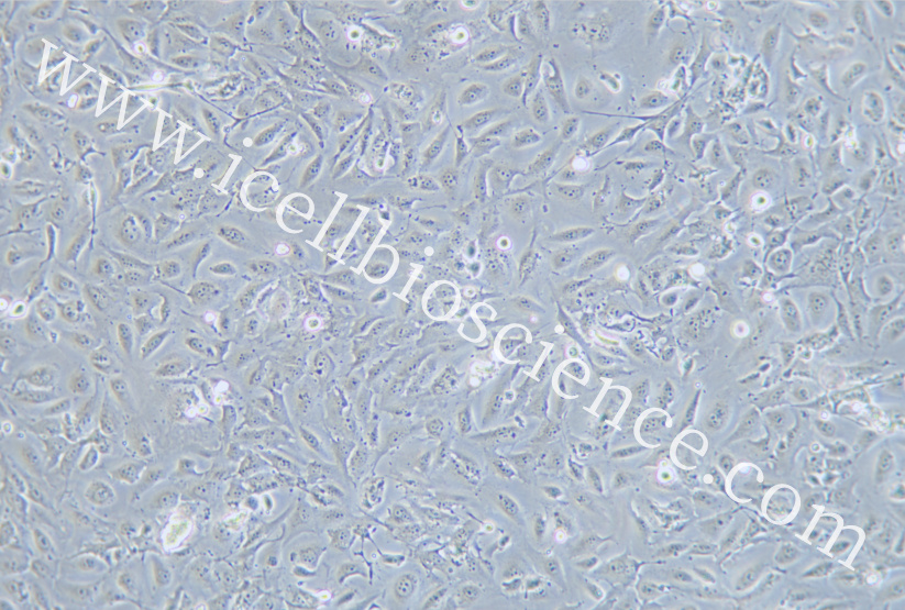 NP69 人永生化鼻咽上皮细胞-原代细胞-STR细胞-细胞培养基-镜像绮点生物