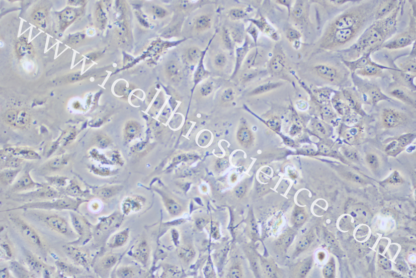 NP69 人永生化鼻咽上皮细胞-原代细胞-STR细胞-细胞培养基-镜像绮点生物