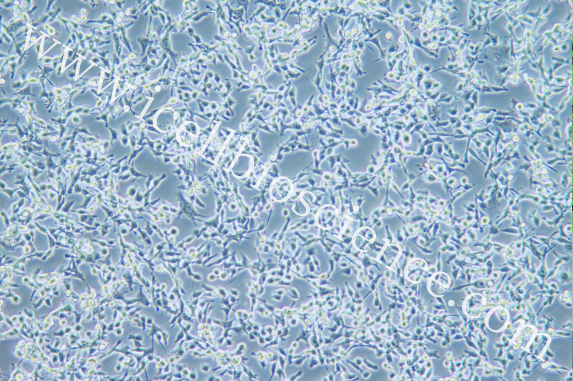 NUGC-4 人胃癌细胞-原代细胞-STR细胞-细胞培养基-镜像绮点生物