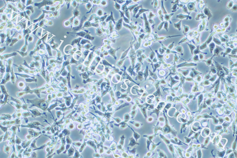 NUGC-4 人胃癌细胞-原代细胞-STR细胞-细胞培养基-镜像绮点生物