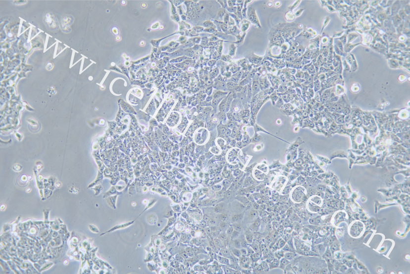OE-33 人食管腺癌细胞-原代细胞-STR细胞-细胞培养基-镜像绮点生物