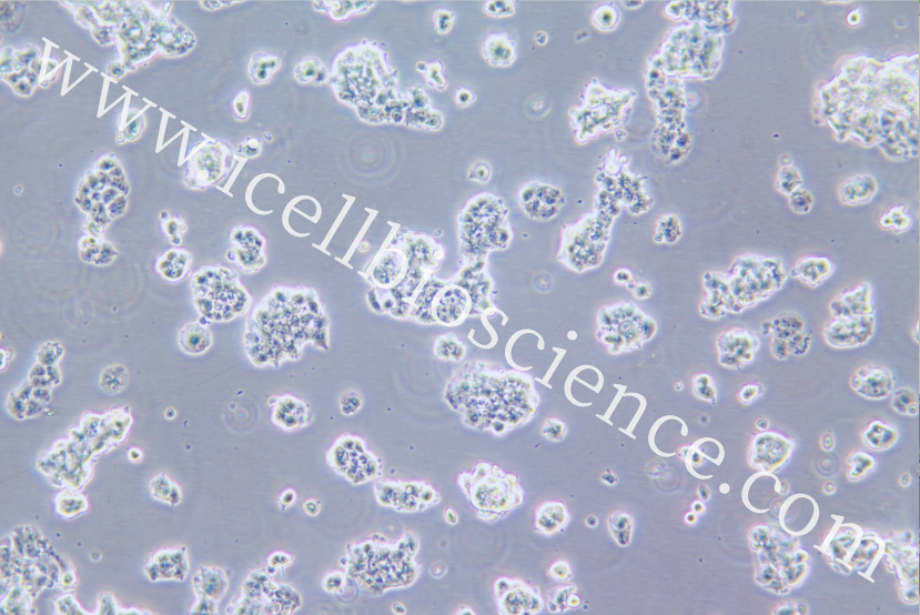 QGP-1 人胰腺癌细胞-原代细胞-STR细胞-细胞培养基-镜像绮点生物