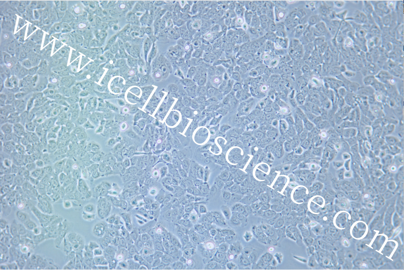 NUGC-3 人胃癌细胞-原代细胞-STR细胞-细胞培养基-镜像绮点生物