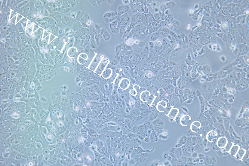 NUGC-3 人胃癌细胞-原代细胞-STR细胞-细胞培养基-镜像绮点生物