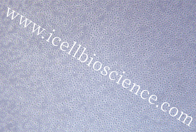 OCI-LY10 人弥漫大B淋巴瘤细胞-原代细胞-STR细胞-细胞培养基-镜像绮点生物