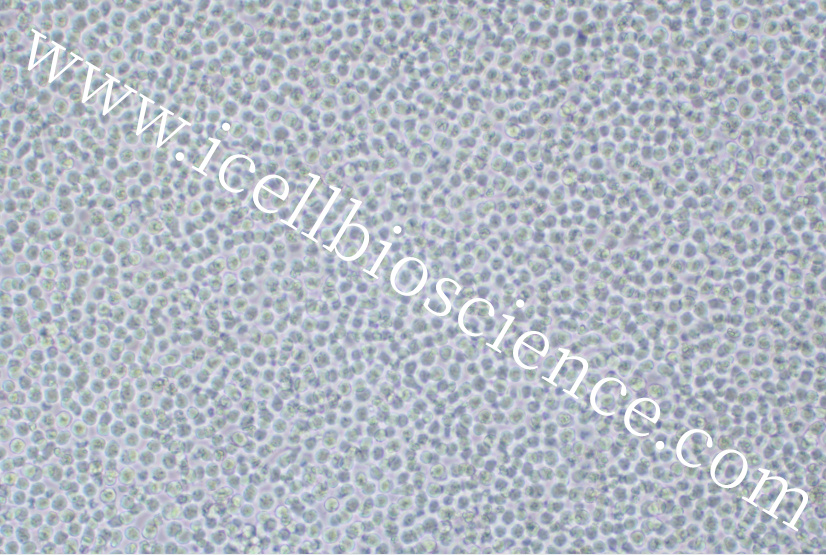 OCI-LY10 人弥漫大B淋巴瘤细胞-原代细胞-STR细胞-细胞培养基-镜像绮点生物