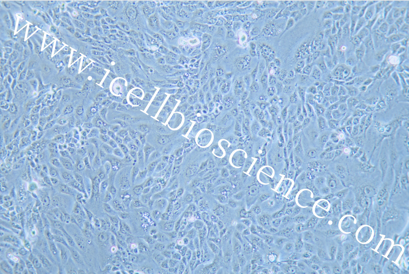 Panc 08.13 人胰腺癌细胞-原代细胞-STR细胞-细胞培养基-镜像绮点生物