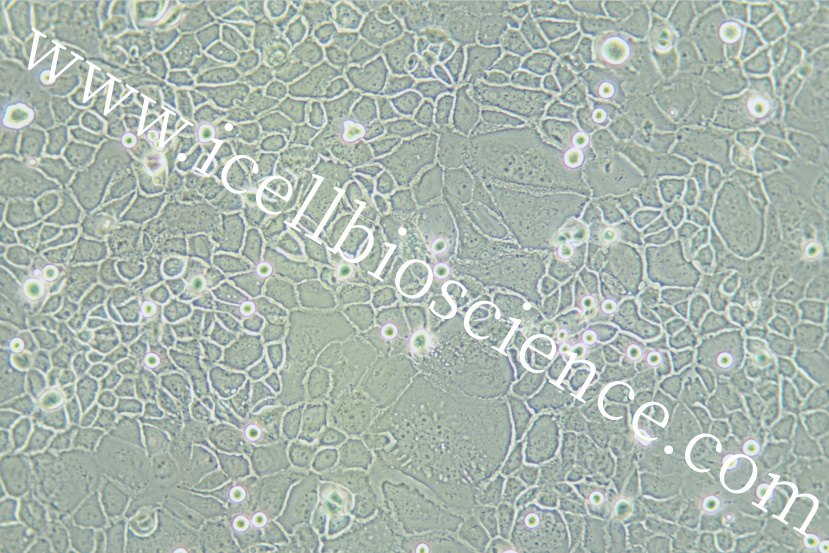SCC-4 人舌鳞状细胞癌细胞-原代细胞-STR细胞-细胞培养基-镜像绮点生物