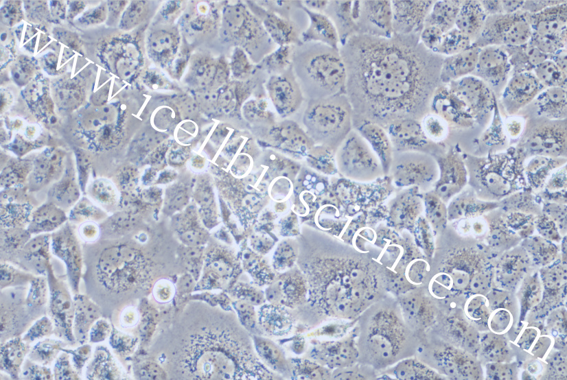TTA1 人甲状腺癌细胞（未分化）-原代细胞-STR细胞-细胞培养基-镜像绮点生物