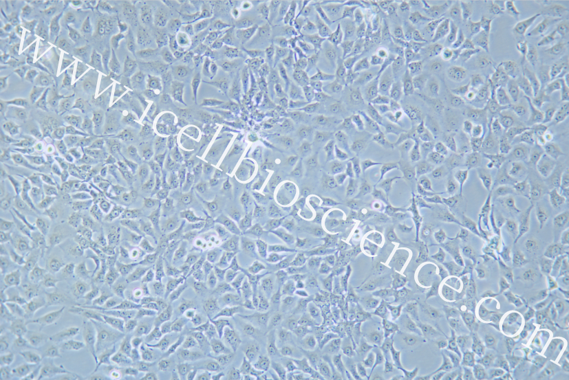 NCI-H2009 人肺腺癌细胞-原代细胞-STR细胞-细胞培养基-镜像绮点生物