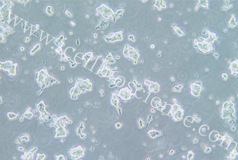NCI-H209 人小细胞肺癌细胞-原代细胞-STR细胞-细胞培养基-镜像绮点生物