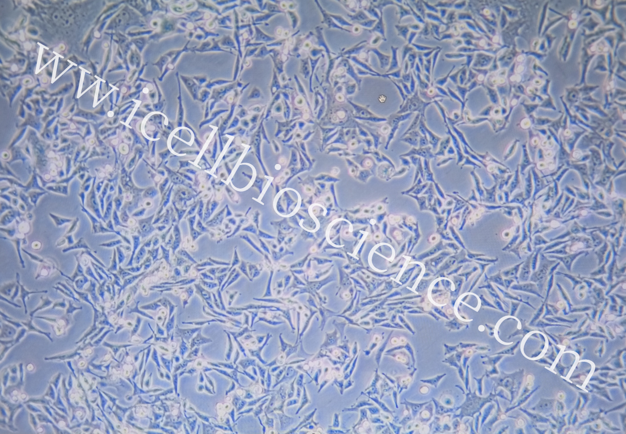 PY8119+GFP 小鼠恶性乳腺癌细胞-原代细胞-STR细胞-细胞培养基-镜像绮点生物