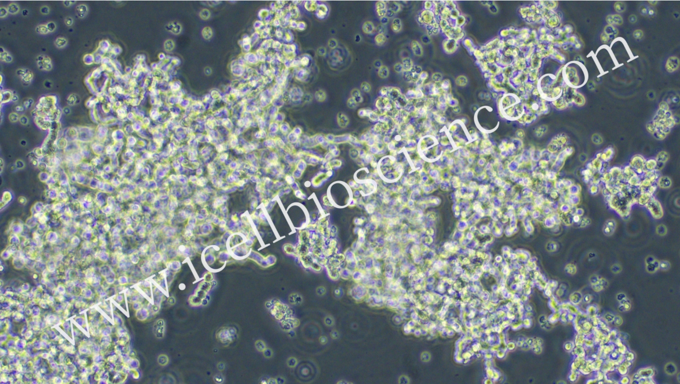 NCI-H526 人小细胞肺癌细胞-原代细胞-STR细胞-细胞培养基-镜像绮点生物