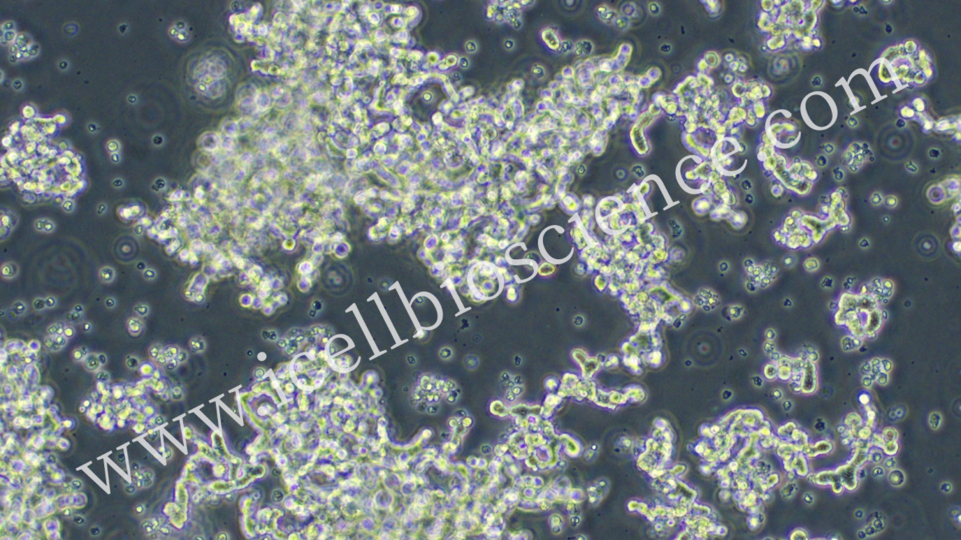 NCI-H526 人小细胞肺癌细胞-原代细胞-STR细胞-细胞培养基-镜像绮点生物