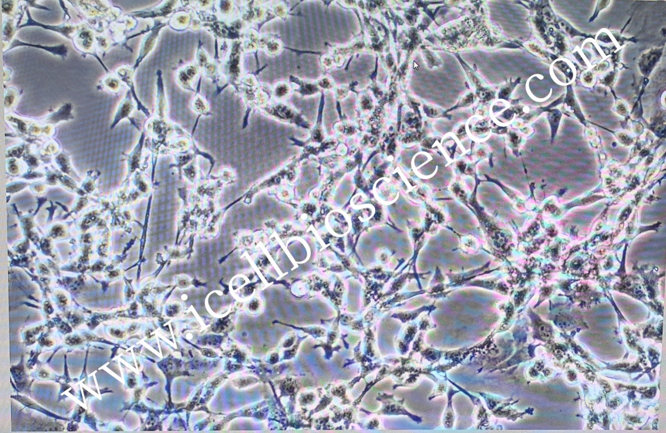 CT26.CL25 小鼠结肠癌细胞-原代细胞-STR细胞-细胞培养基-镜像绮点生物