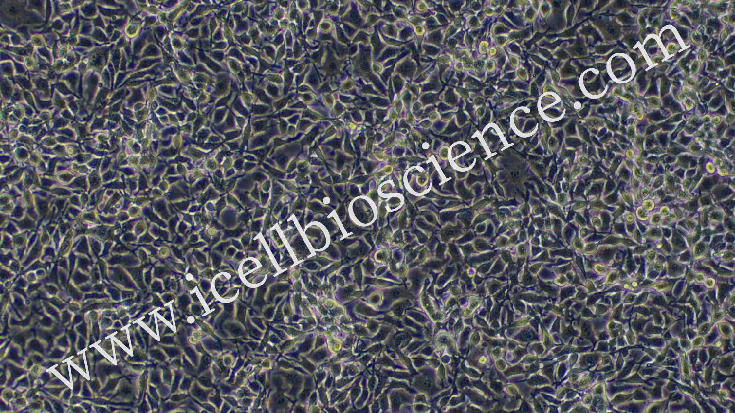 B16-F10/OVA 小鼠黑色素瘤细胞转染OVA-原代细胞-STR细胞-细胞培养基-镜像绮点生物