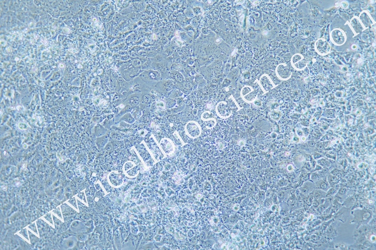 BeWo 人胎盘绒膜癌细胞-原代细胞-STR细胞-细胞培养基-镜像绮点生物