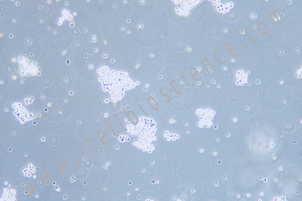 NCI-H660 人神经内分泌前列腺癌细胞-原代细胞-STR细胞-细胞培养基-镜像绮点生物